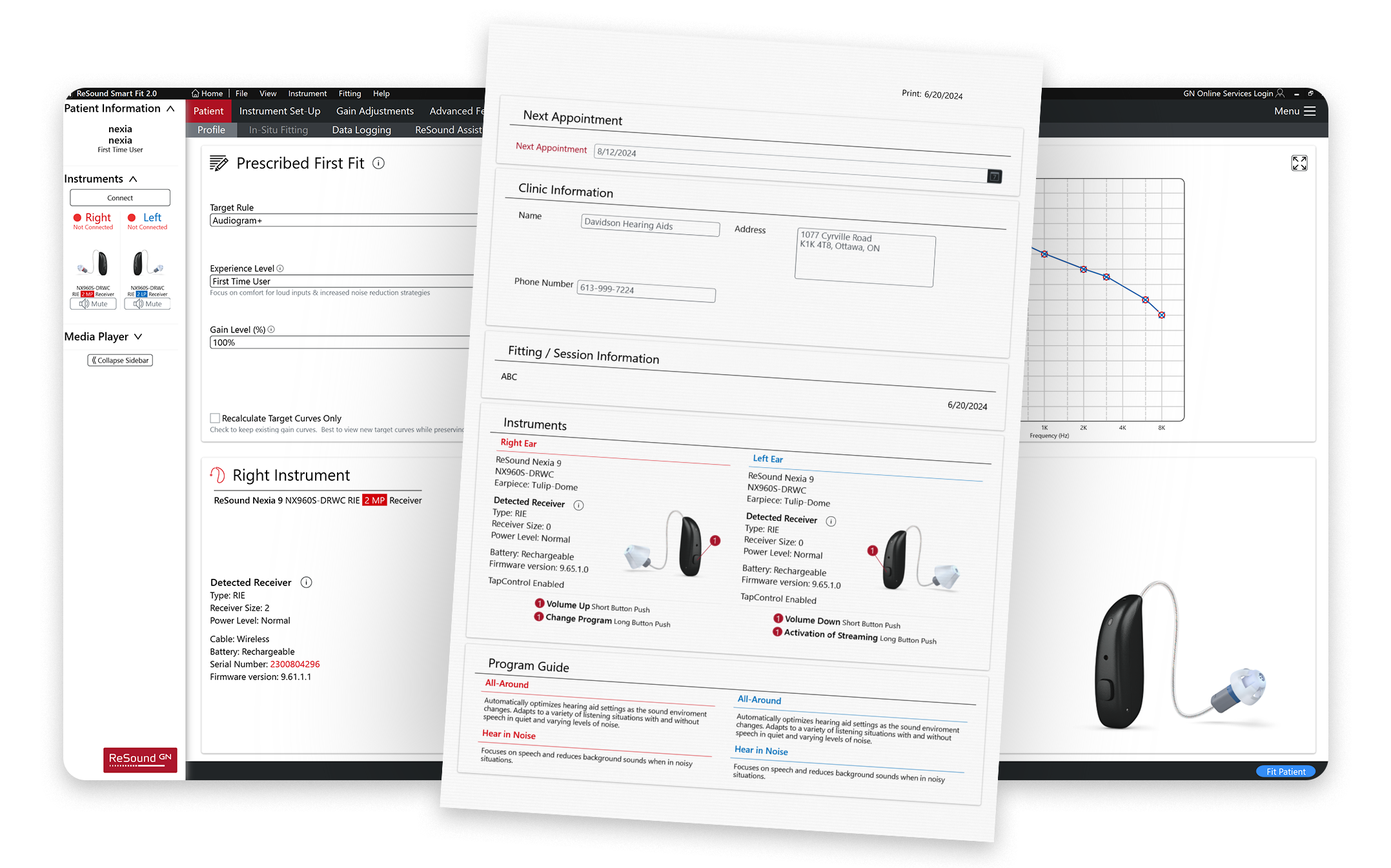 Hearing aids ReSound - NEW! ReSound Smart Fit 2.0 - Enrich your fitting ...